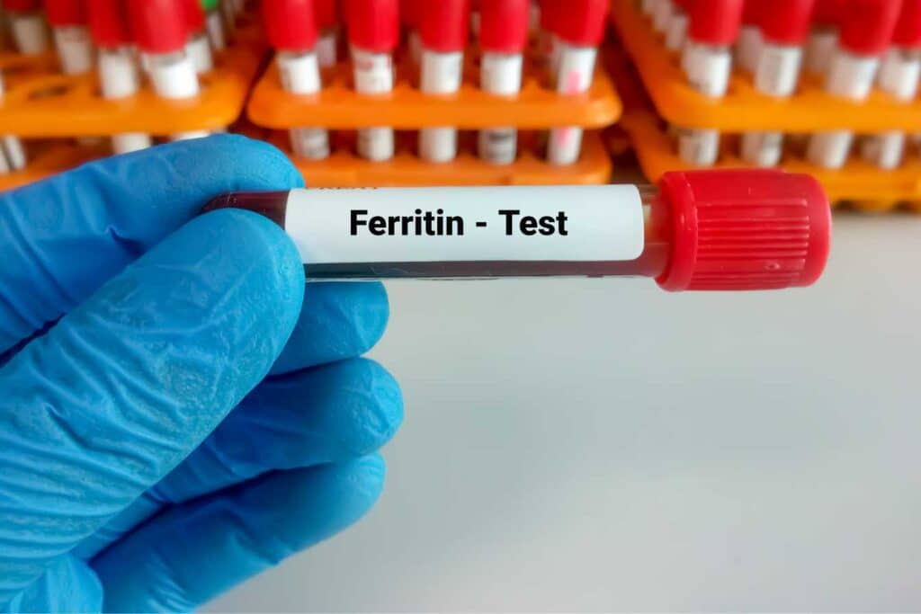 À quel taux de ferritine faut-il débuter les saignées ? tout ce qu’il ...