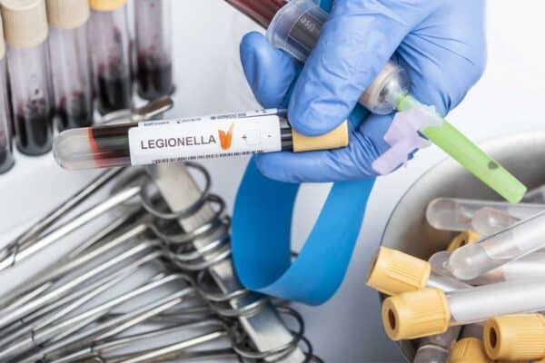 Comment éviter la légionellose ? – Cometh