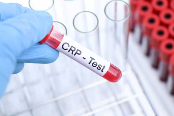 Crp prise de sang : tout savoir sur l’inflammation et l’interprétation ...